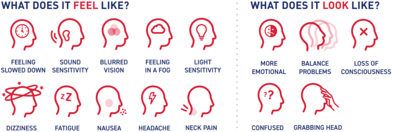 Concussion | British Horseracing Authority